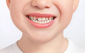 Is A Gap Between Front Teeth Lucky Astroculture