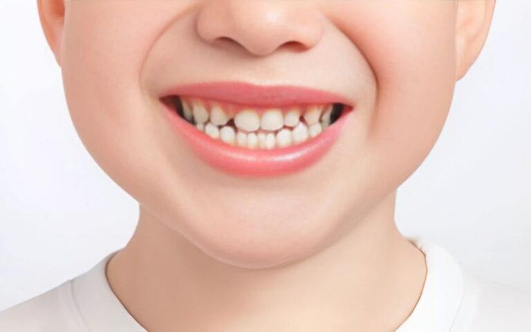 Is A Gap Between Front Teeth Lucky Astroculture